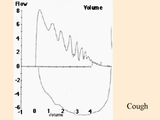 variable effort can be detected by a flow volume loop that fails to ...